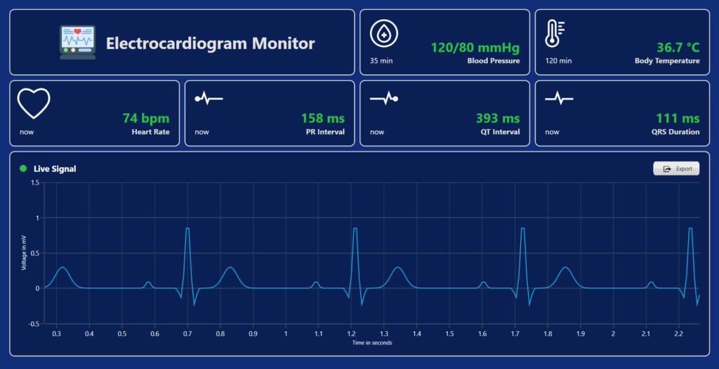 How to Build a Real-Time ECG Monitoring Dashboard in WPF Using a ...